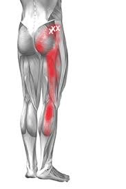 Wat zijn triggerpoints?
